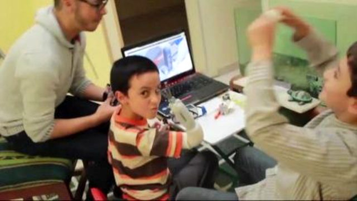 New Lego Prosthetic Lets Kids Build Their Own Arm - Haberler