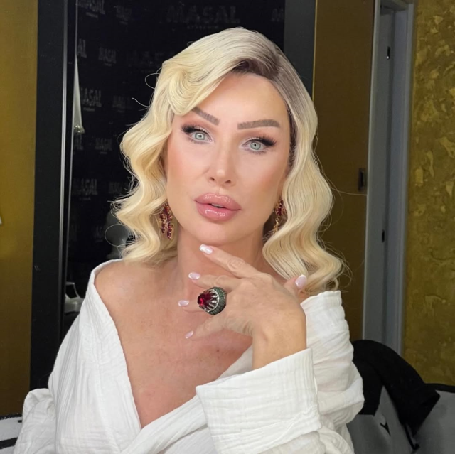 Seda Sayan'ın yüzündeki şişliğin sebebi ortaya çıktı - Son Dakika